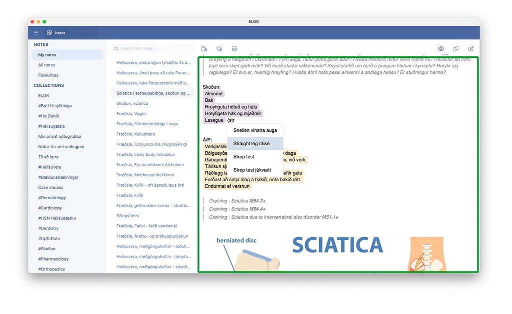 Free Xojo control - RTEdit (Rich Text Editor) - General - Xojo Programming Forum